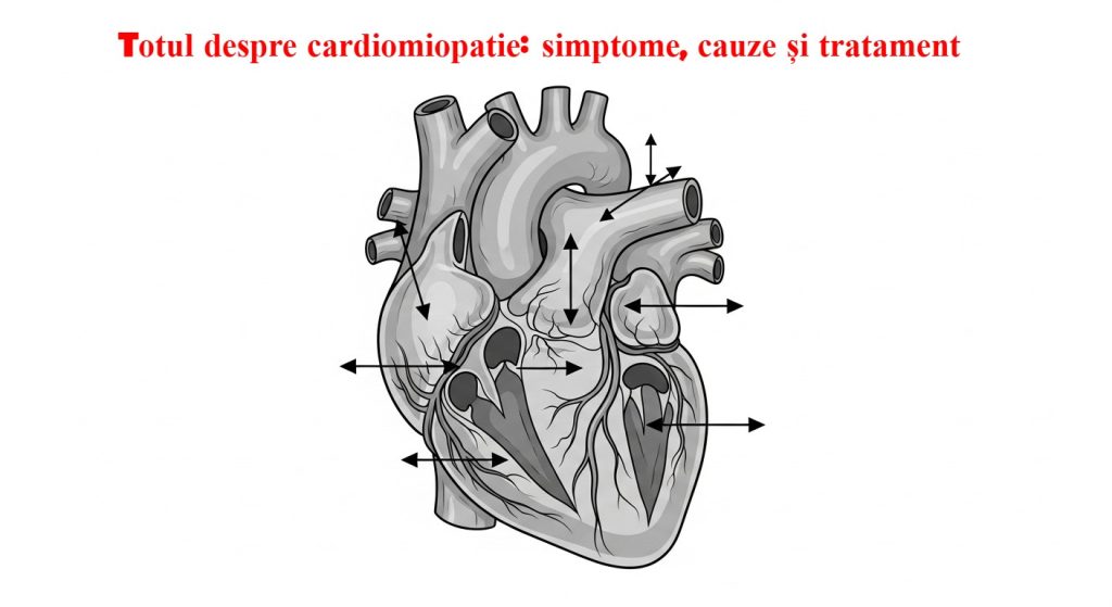 Totul despre cardiomiopatie: simptome, cauze și tratament» Enayati ...